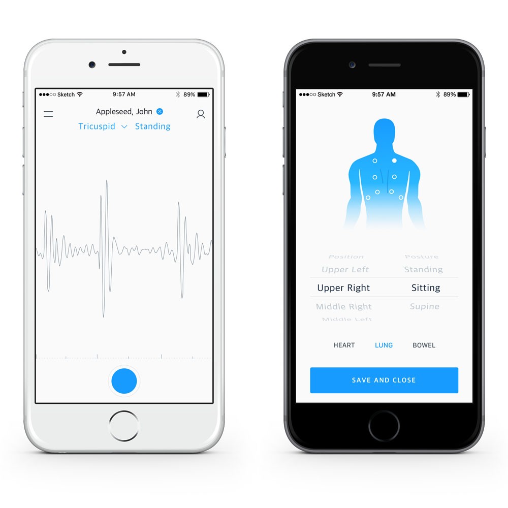 Diglo | Hearing Loss & Deaf Products | Harris Communications